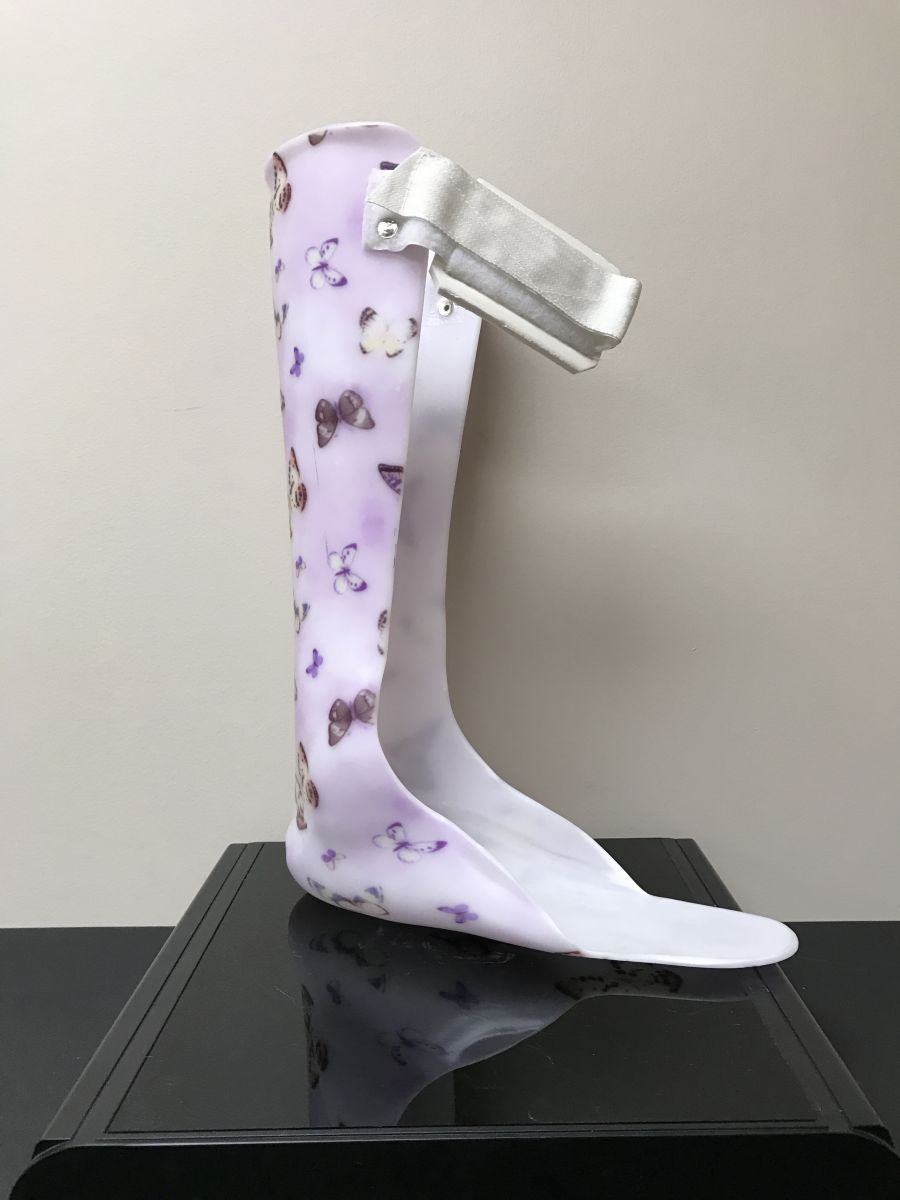 : Image Gallery - Yanke Bionics | Ohio