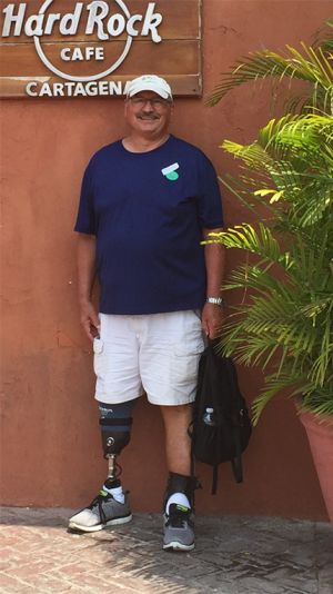 So, what is it that we amputees really want? ‹ News - Yanke Bionics | Ohio